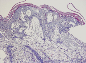 A Case of Orf; Creating a Business Plan - Practical Dermatology